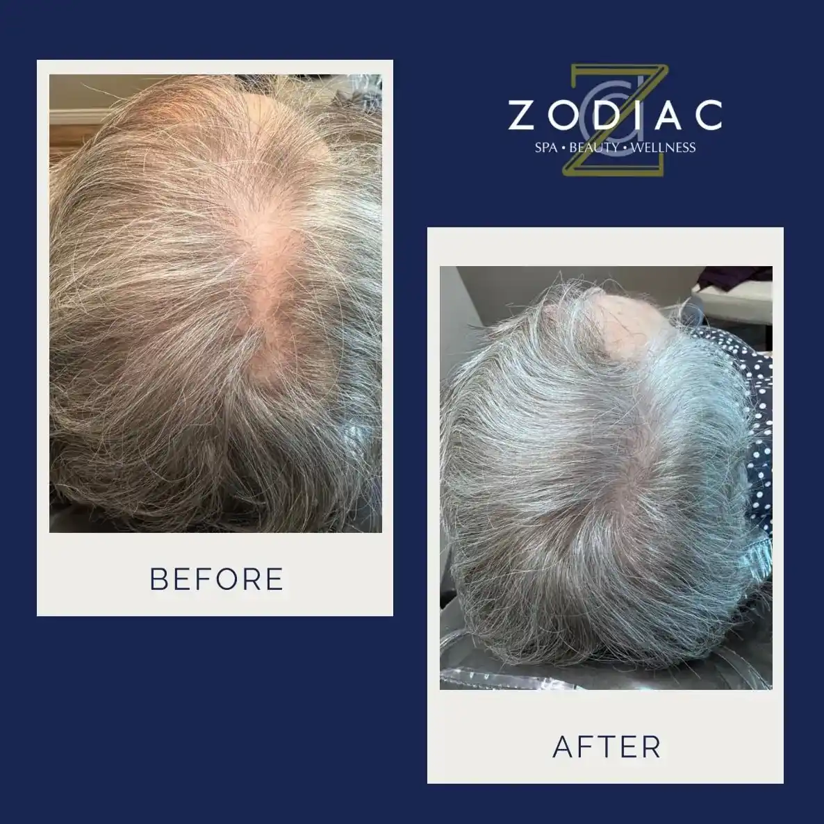 Aesthetic Treatments Before & After Images In Herriman, UT